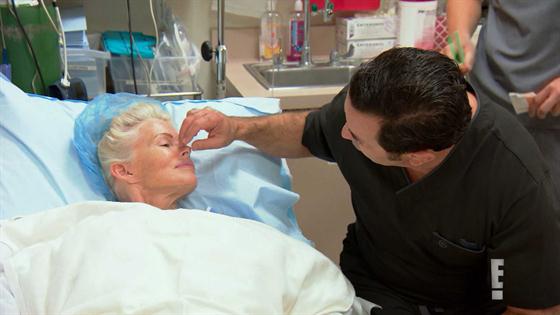 "Botched" Patient Has a Nose Conundrum