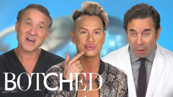 Unemployed & Overfilled: Jonathan’s Lip Filler Disaster | Botched | E!