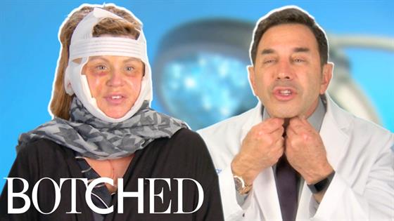 Dr. Nassif Fixes Lisa’s Facelift Gone Wrong | Botched | E!